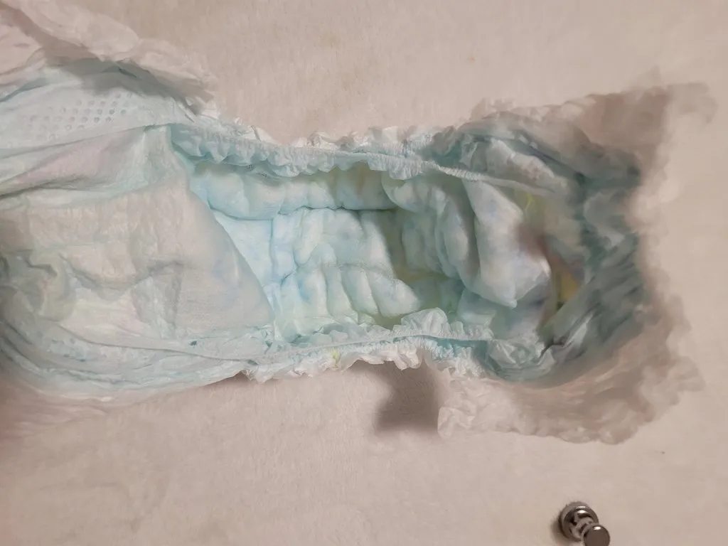 77bfd707ac31681a.webp - dump.li